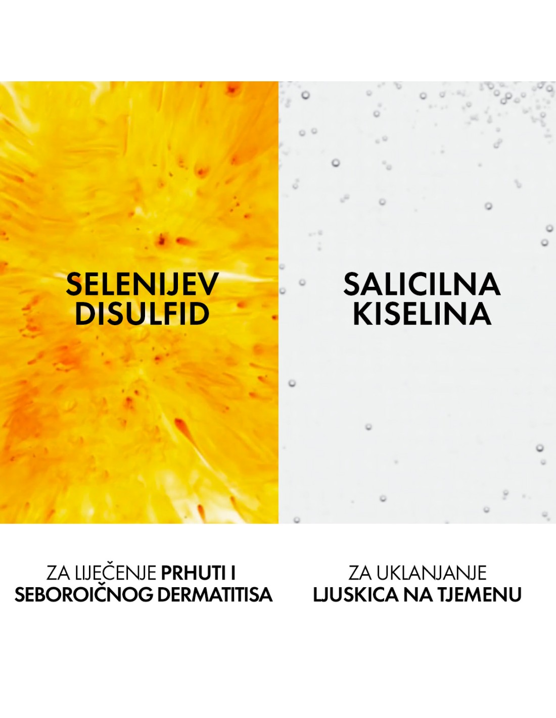 VICHY DERCOS DS ŠAMPON PROTIV PERUTI ZA SUHU KOSU REFIL 500ML ...